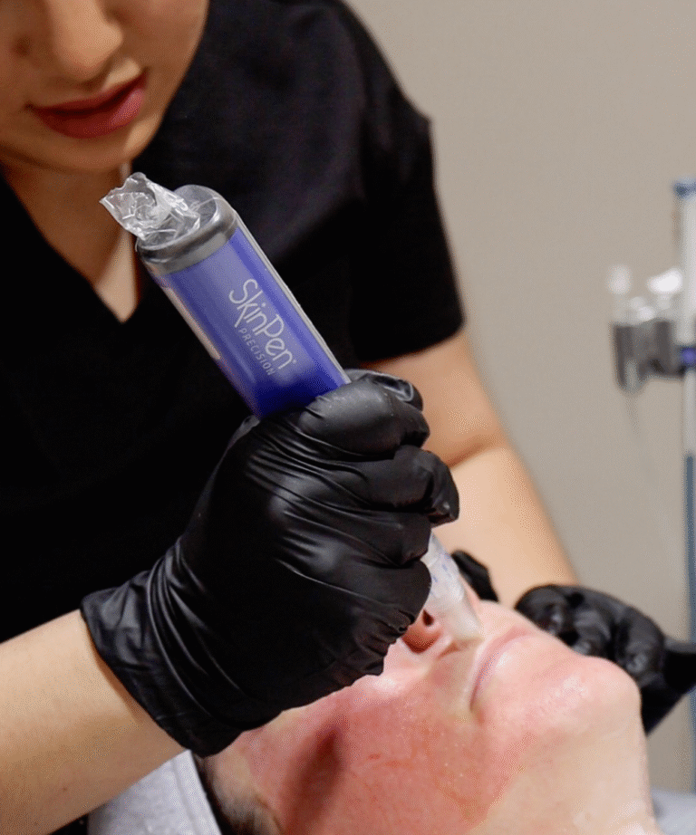 SkinPen Microneedling Treatment in Dallas – Wellness Code